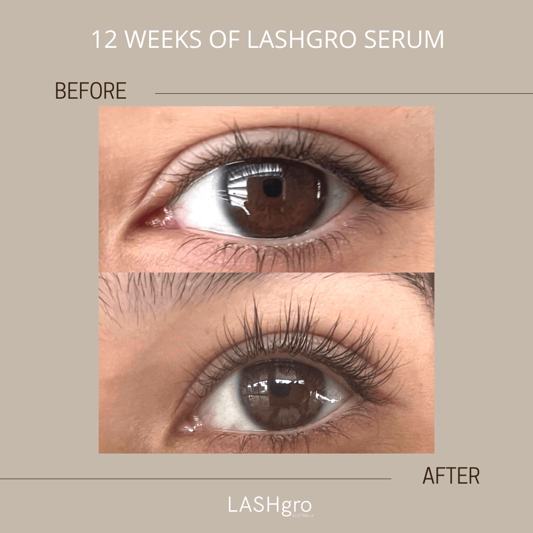 Eyelash Growth Serum | LASHgro Australia